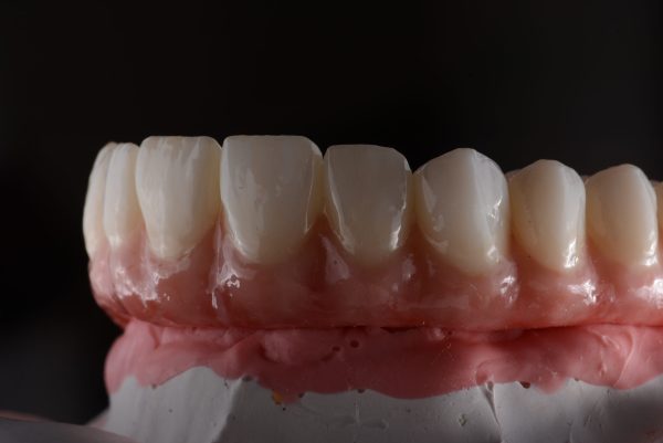 A Game-Changer in Modern Dentistry: Full-Arch Fixed Prostheses with ...